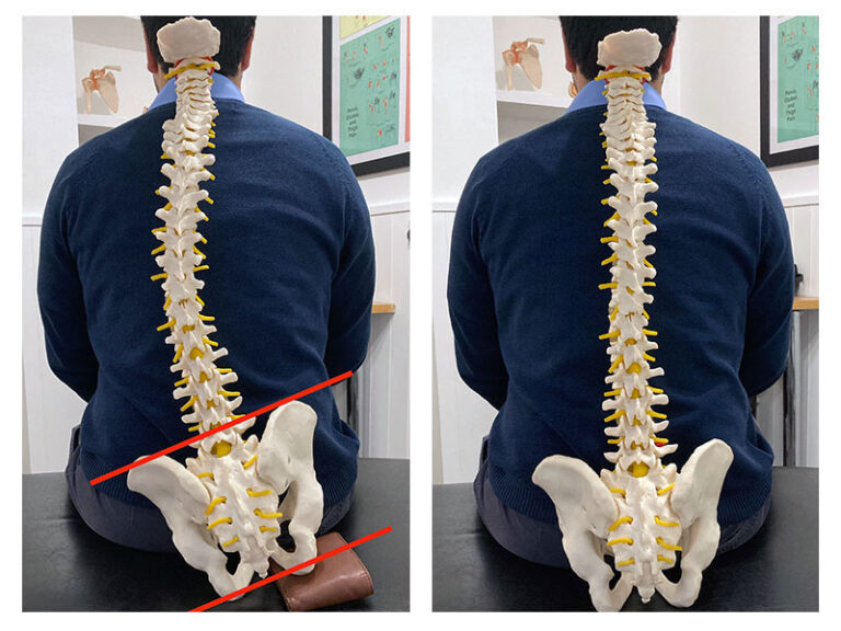 Common Causes of Back Pain - Hands of The State Massage